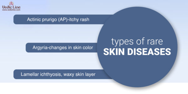 Types of skin diseases and there side effects | Vedicline