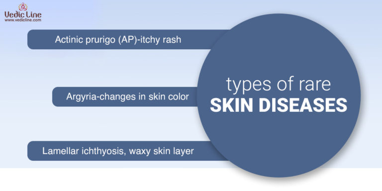 Types of skin diseases and there side effects | Vedicline